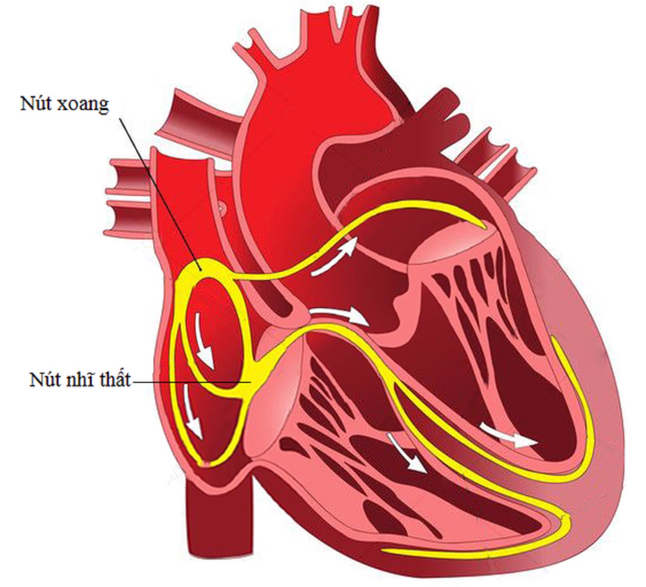 Suy nút xoang tim: Nguyên nhân, triệu chứng và điều trị